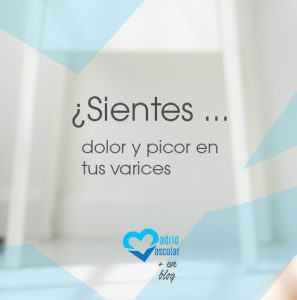 Dolor en varices – Madrid Vascular
